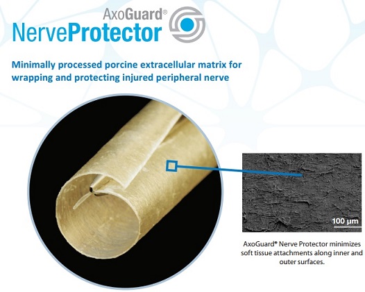 MadTrauma | Distribución de Material Médico en España y Portugal